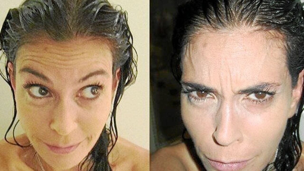 Teri Hatcher contra el botox