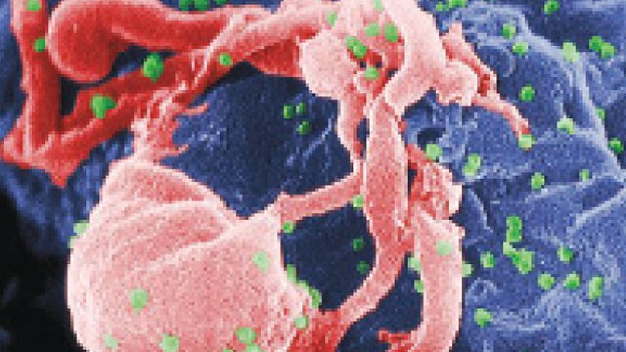 El VIH crece incluso cuando no es detectable en la sangre