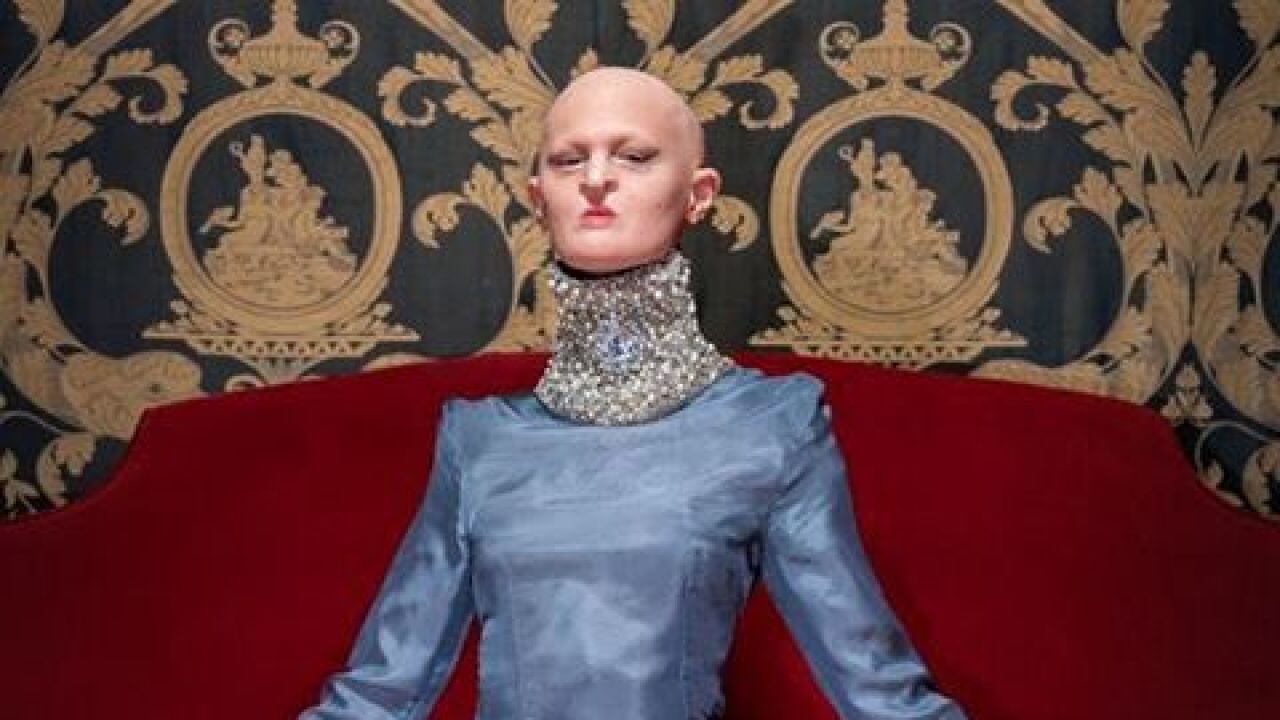 La modelo calva y sin dientes que ha triunfado en la Semana de la Moda ...