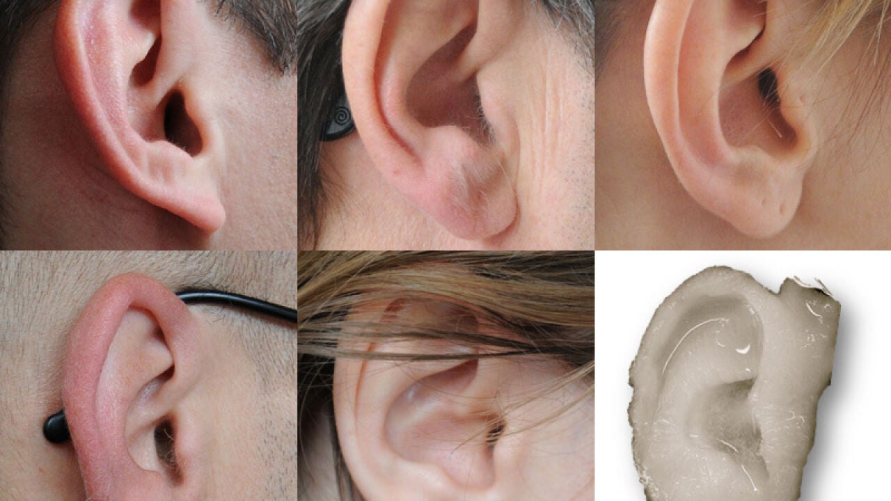 Una bacteria ayuda a fabricar orejas humanas