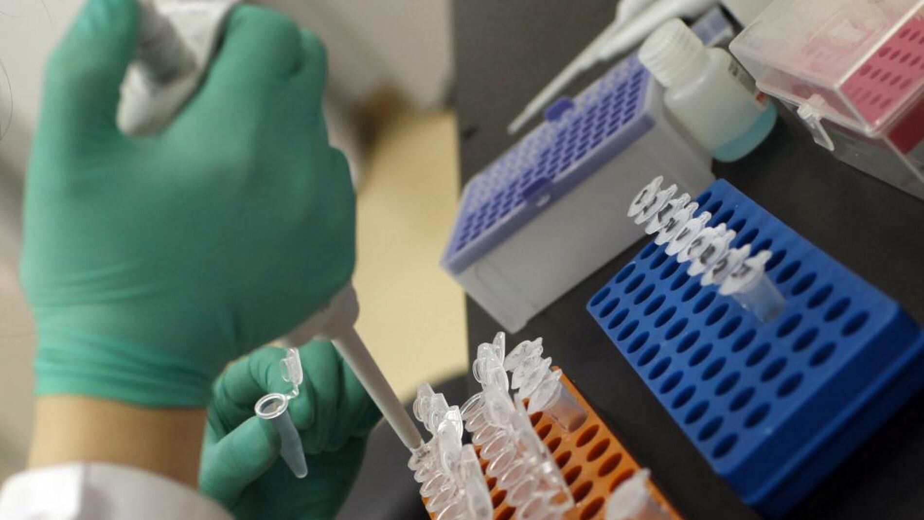 Una nueva vacuna para luchar contra el sida, con sello español