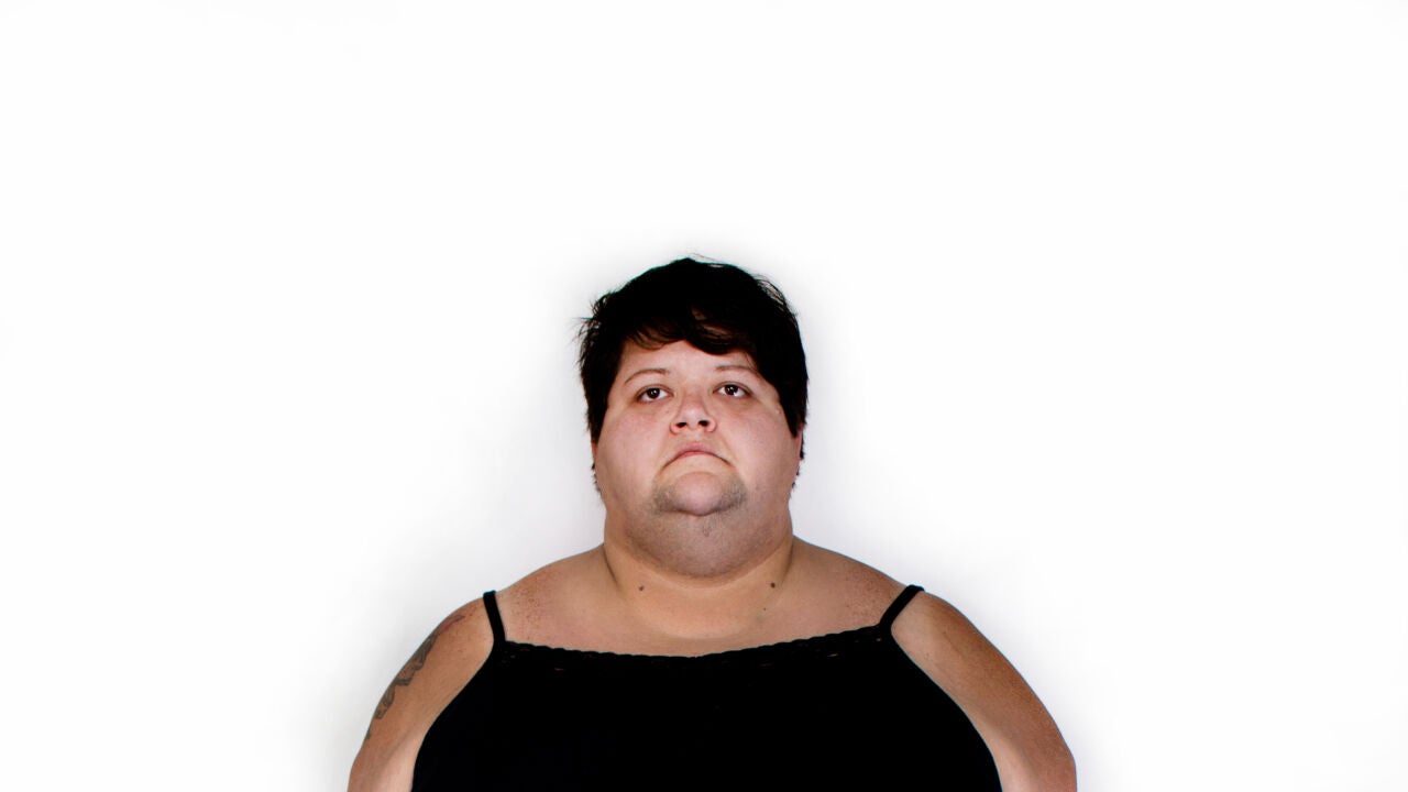 El drama de “Mi vida con 300 kilos”, casos extremos