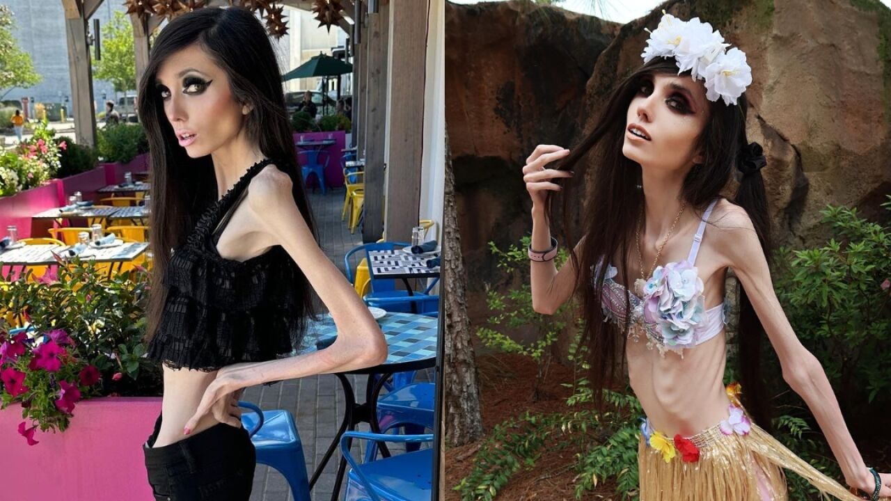 ¿Promueve la anorexia? La polémica influencer que solo pesa 27 kilos