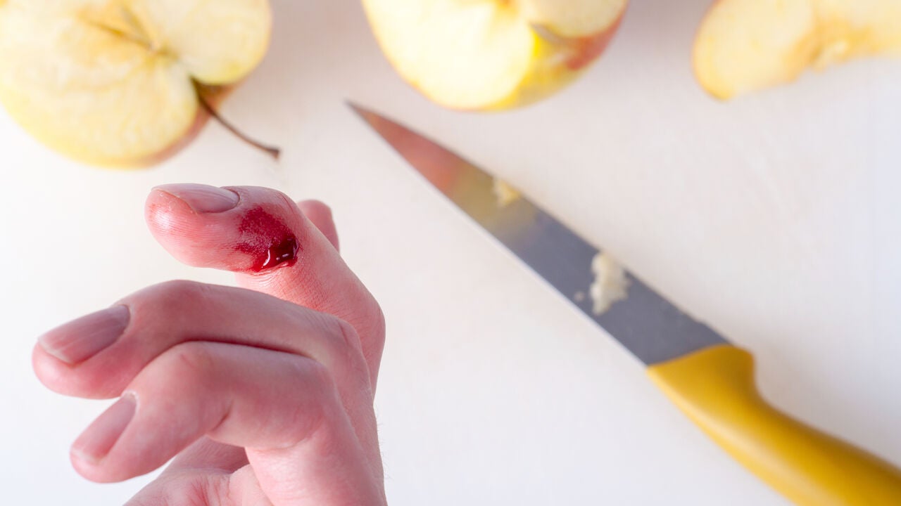 Cómo curar las heridas y cortaduras producidas por un cuchillo