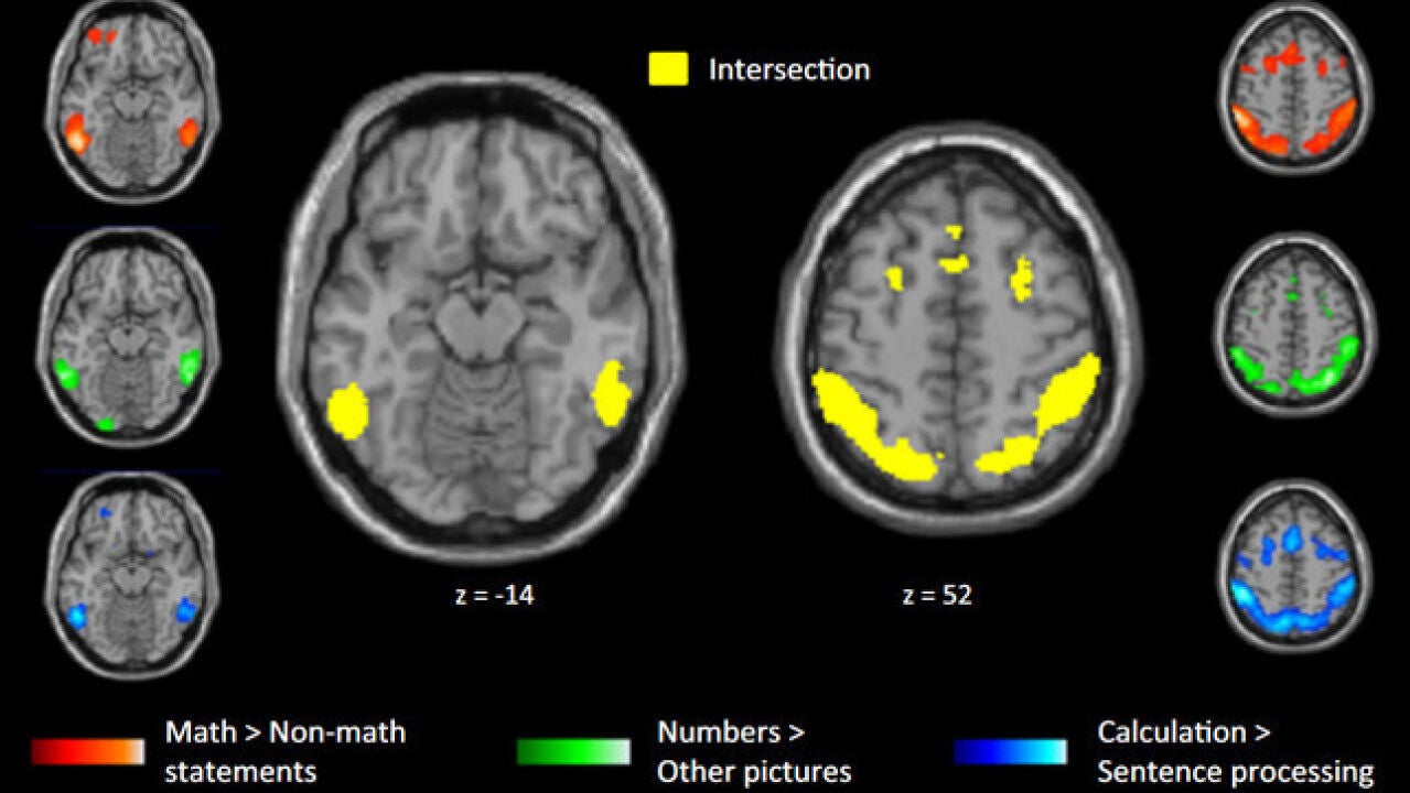 Describen cómo reacciona el cerebro a las matemáticas