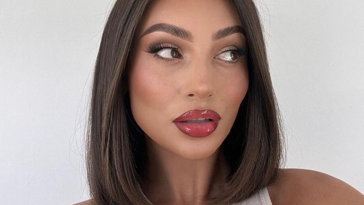 Cherry Coke lips: la tendencia en labios que arrasa en Tik Tok