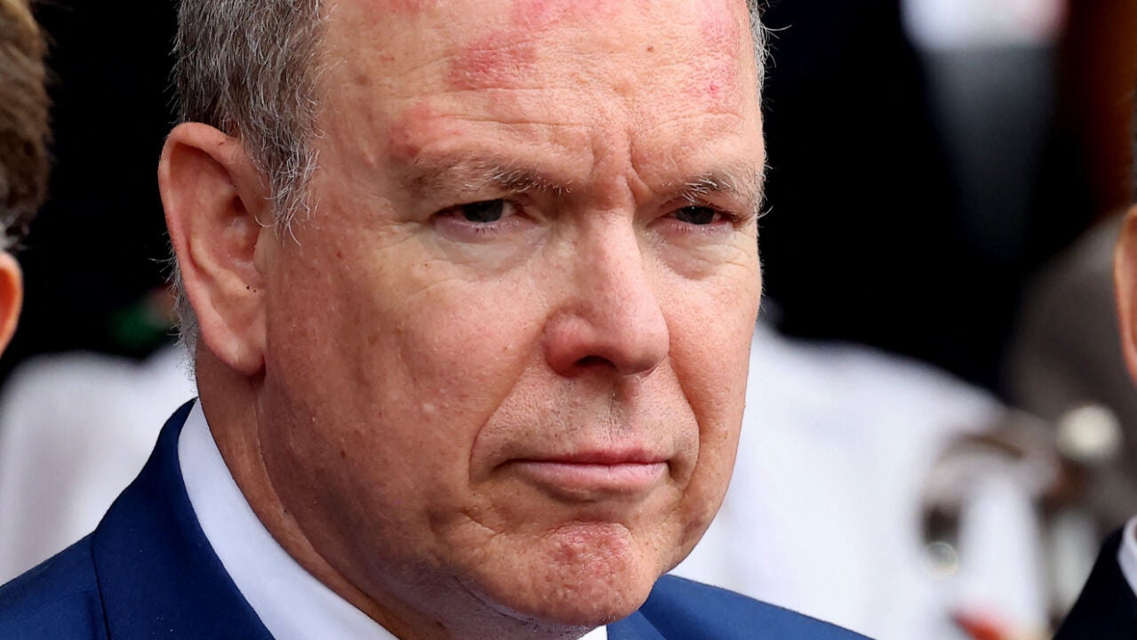 Alberto de Mónaco reaparece con unas preocupantes machas rojas en su rostro